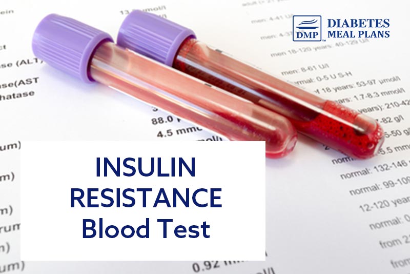 Pre-diabetes/ Insulin Resistance Test